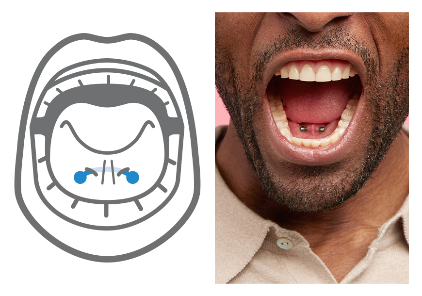 bouche piercings | Crazy Factory magasin de piercings en ligne