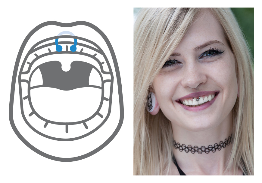 Mundpiercing | Crazy Factory Piercing Online Shop